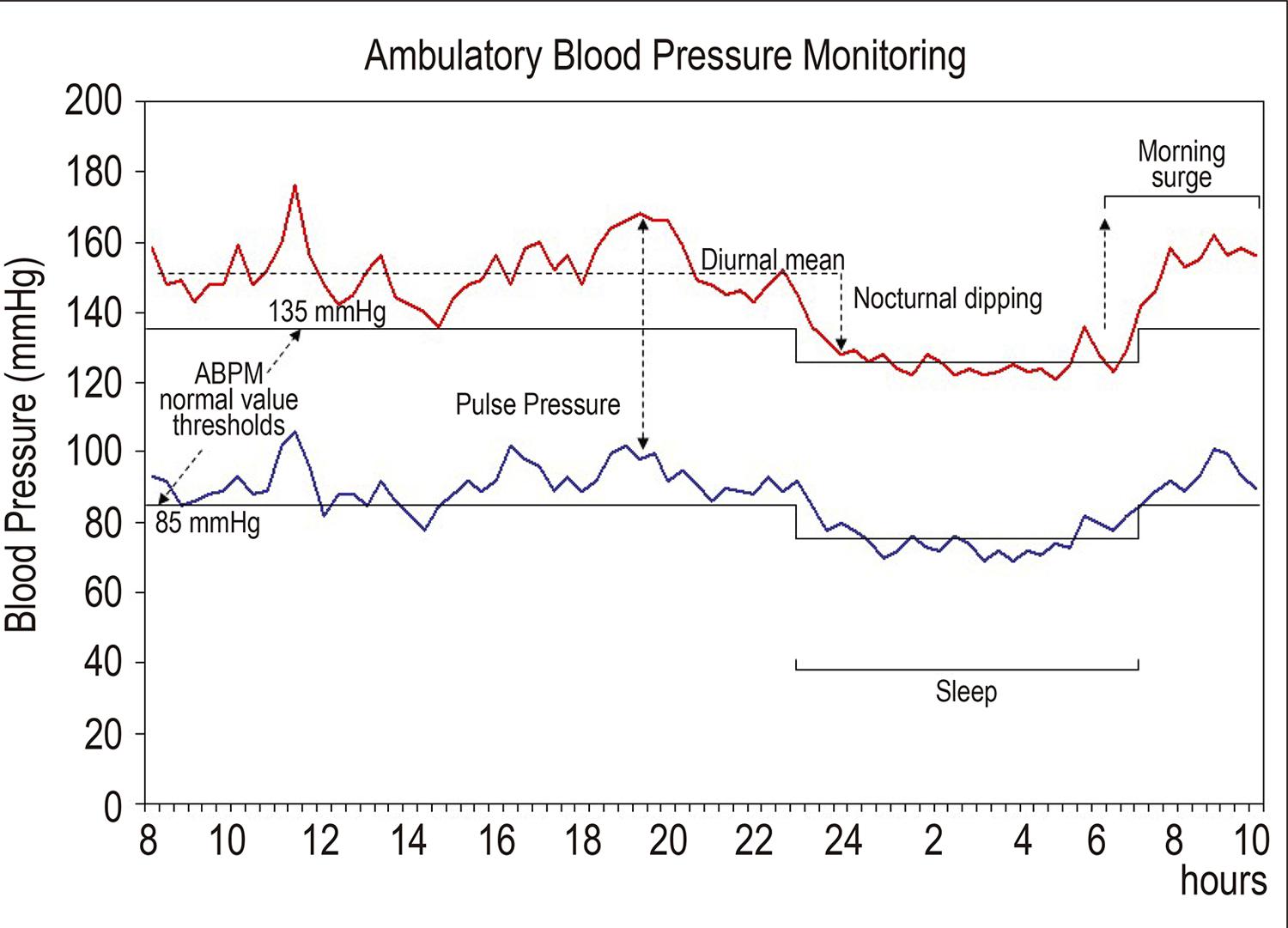 Nocturnal Blood Pressure Dipping And The Autonomic Nervous System ABC 